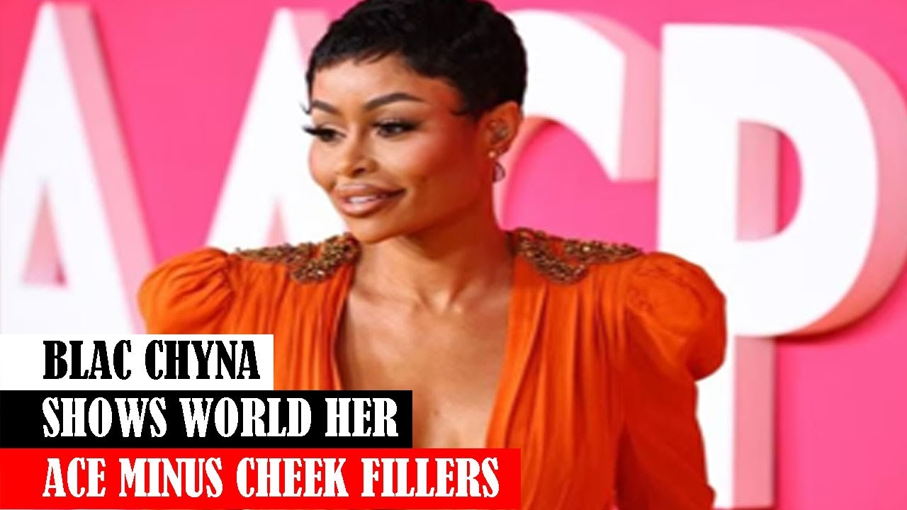 BLAC CHYNA SHOWS WORLD HER FACE MINUS CHEEK FILLERS - YouTube