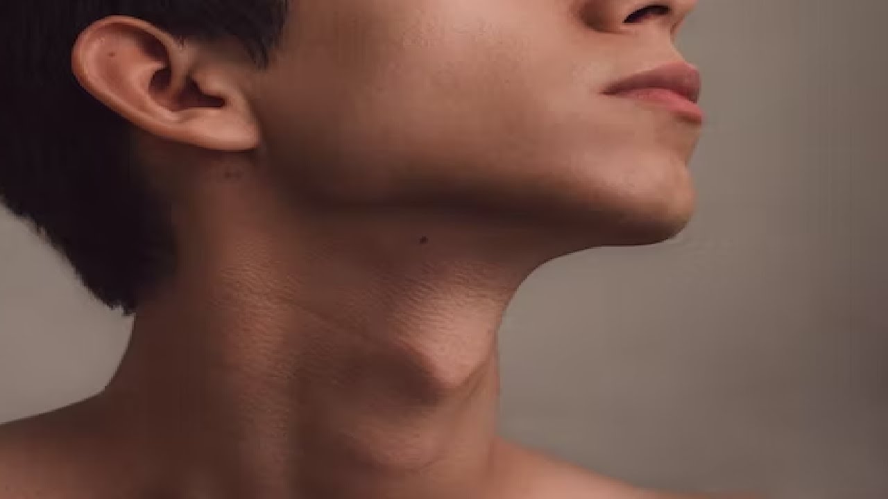 how to get a sharp jawline in one week - YouTube