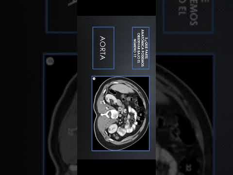 preguntás relacionadas a Anatomía Topográfica