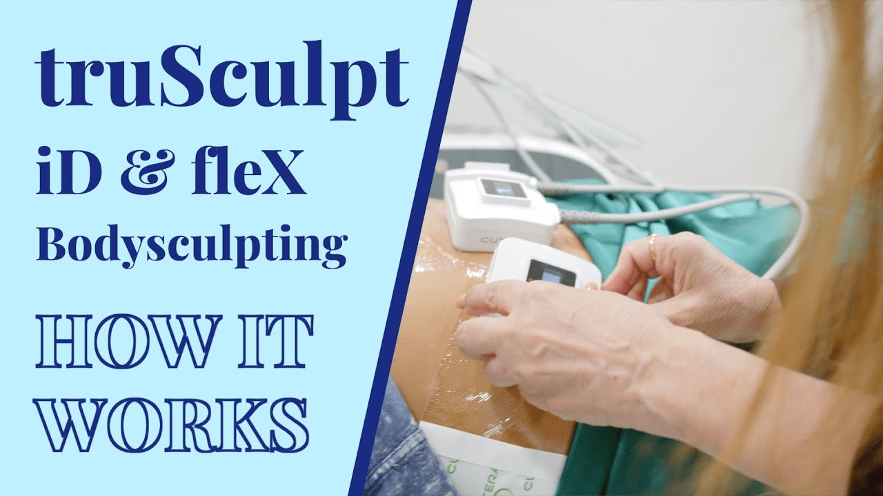 truSculpt iD and truSculpt fleX: Bodysculpting at BYou [How It Works ...