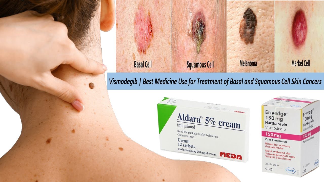 Vismodegib | Best Medicine Use For Treatment of Basal and Squamous Cell ...