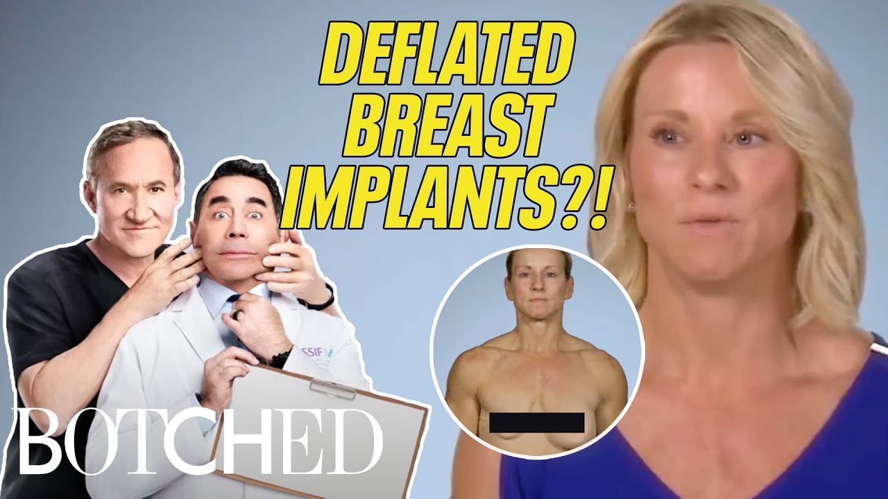 5 WEIRD Botched Breasts | Botched | E! - YouTube