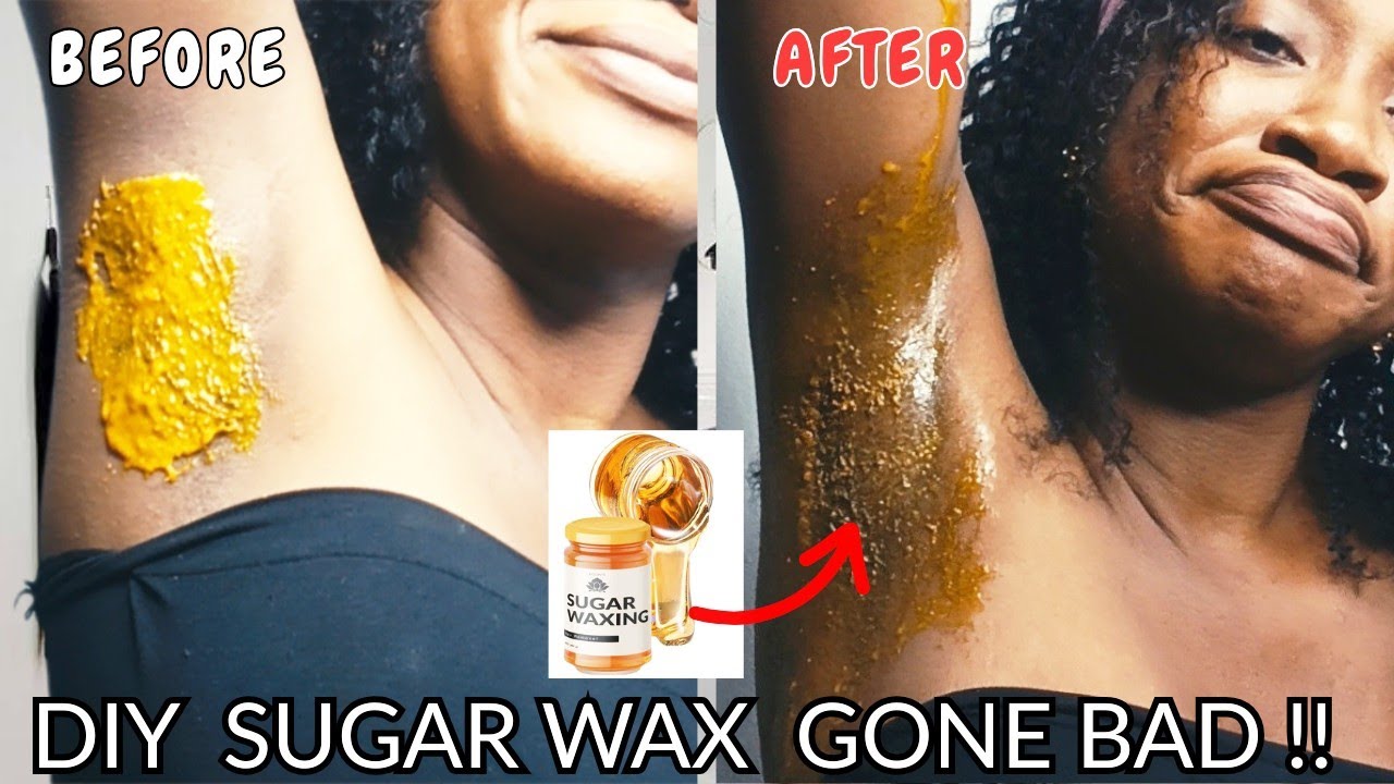 Don’t Make This DIY HAIR REMOVAL Sugar Wax Mistake!! |Underarm + Facial ...