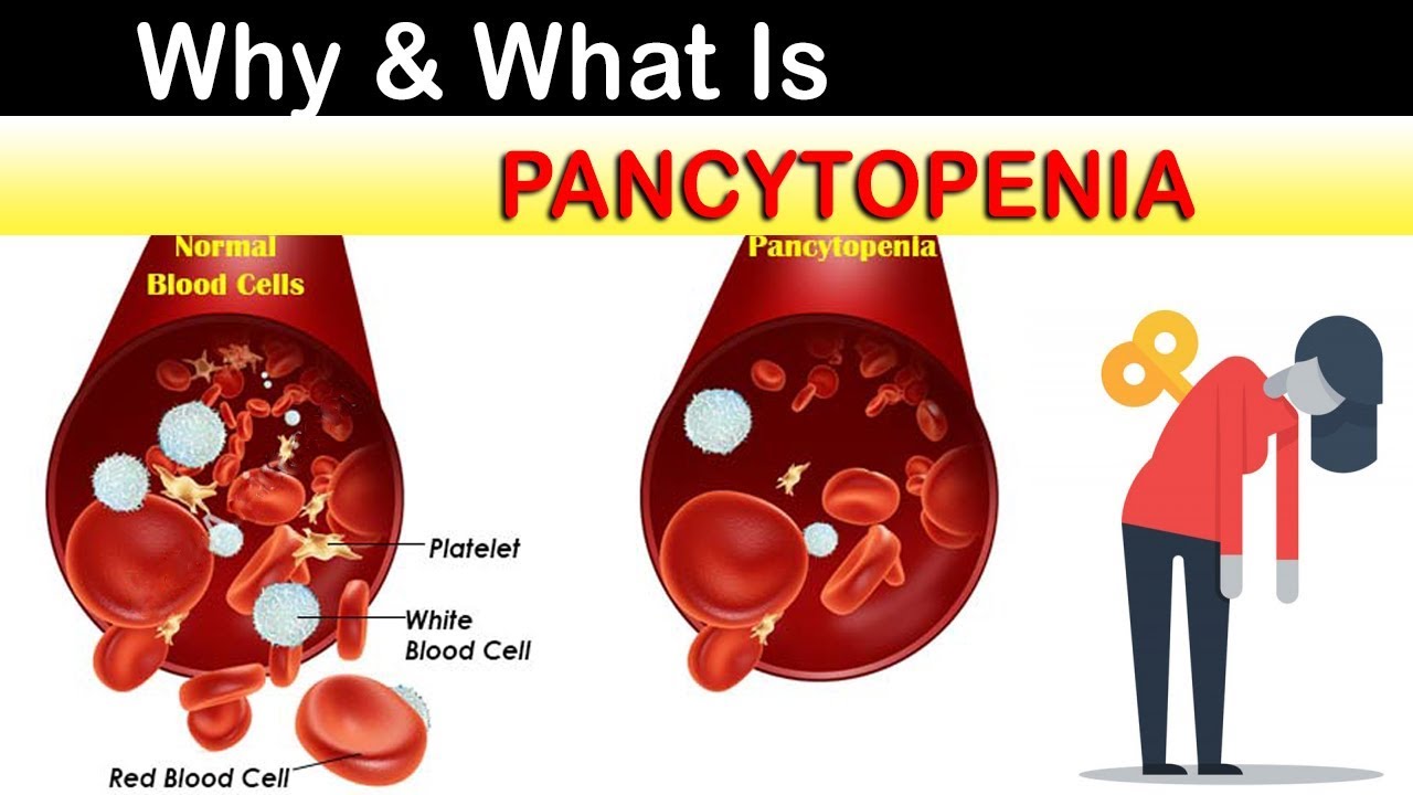Why & What Is Pancytopenia ? - YouTube