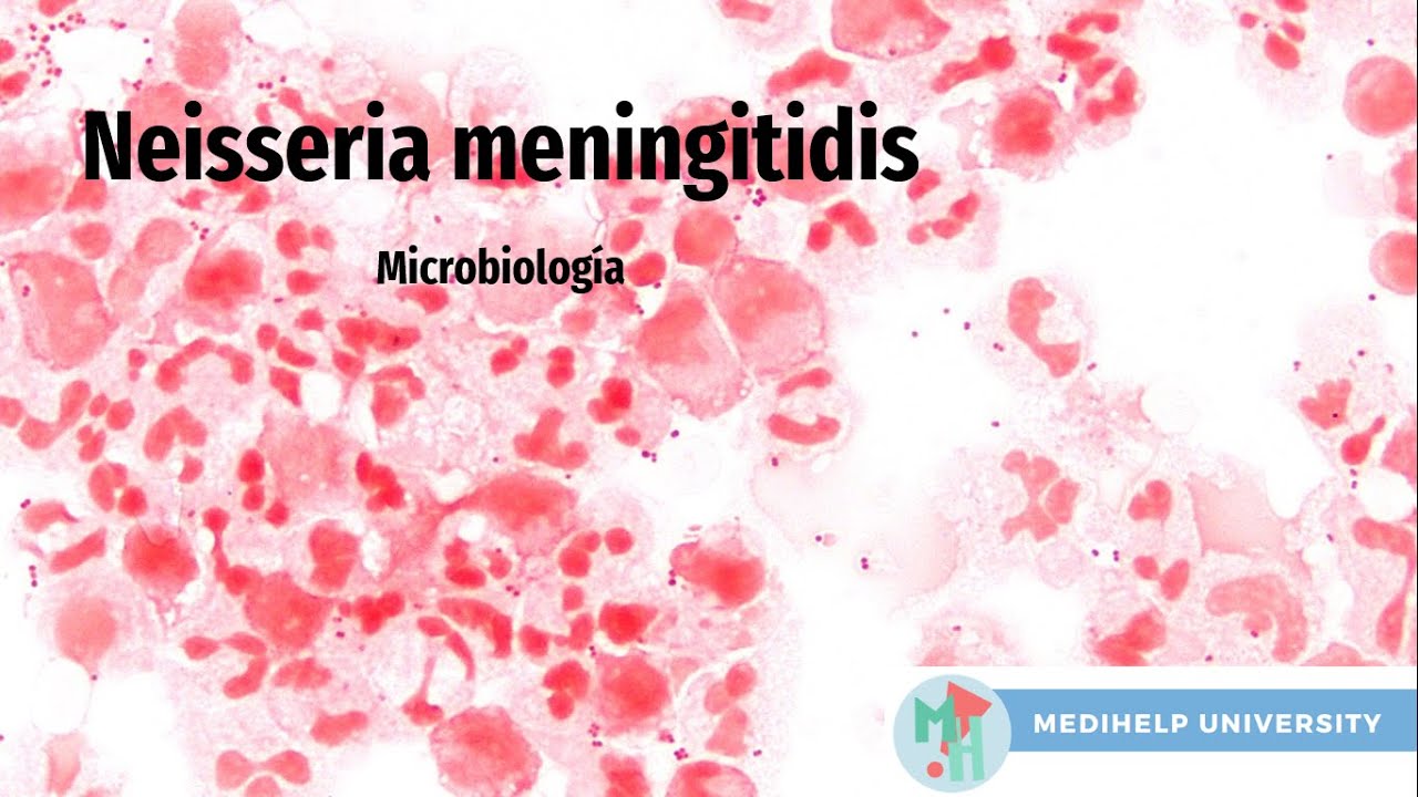 Neisseria Meningitidis - ¿Infección en tu cerebro? - YouTube