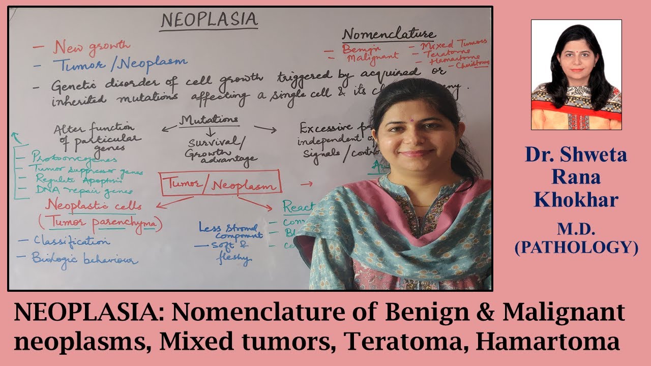 NEOPLASIA: Nomenclature of Benign & Malignant neoplasms, Mixed tumors ...