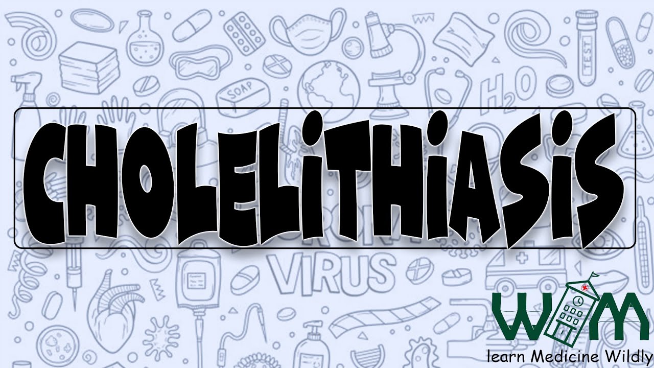 Cholelithiasis | Gallstone | Treatment | Presentation | Diagnosis ...