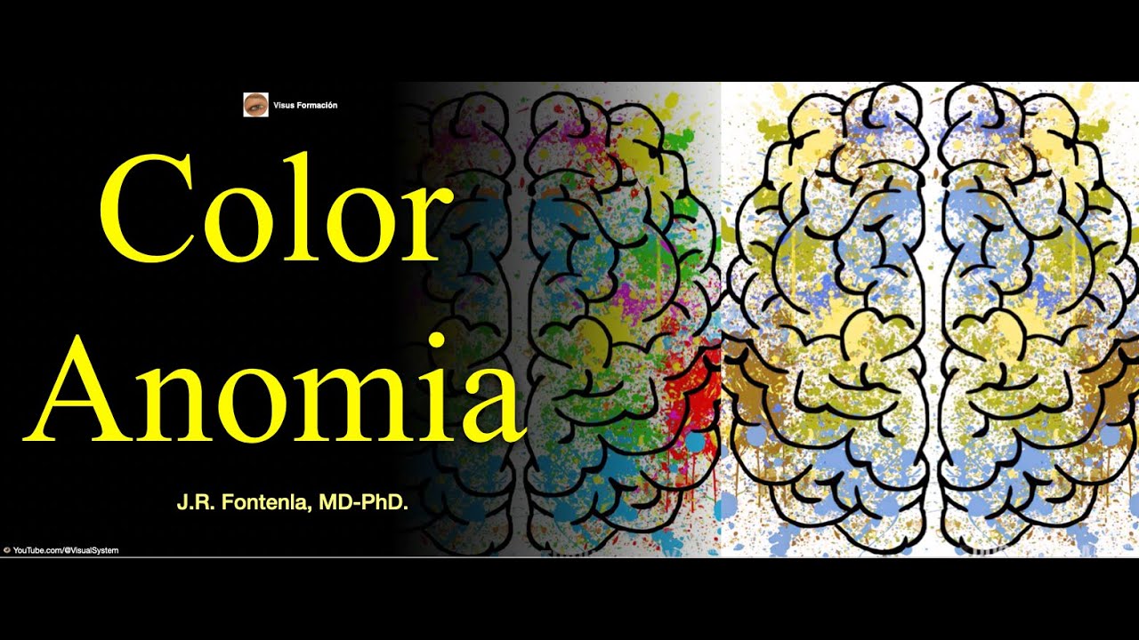 Color Anomia. - YouTube