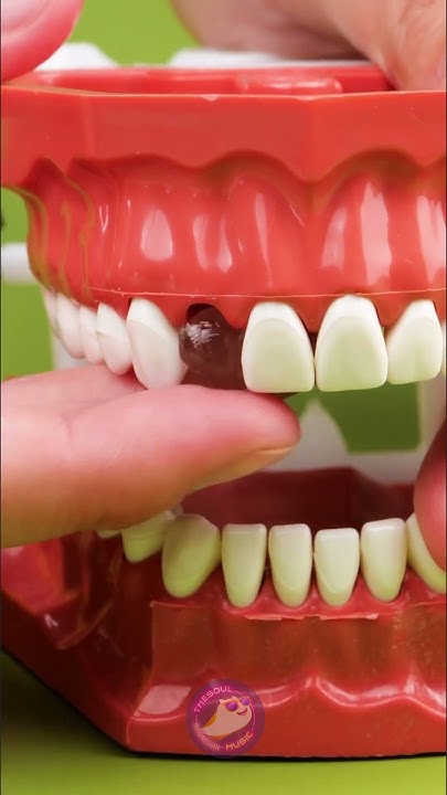 Tingkatkan Shorts Anda dengan "DAVID KAE - DEEPER" 🎶😆 Rahang Imut Butuh Penambalan Gigi - YouTube