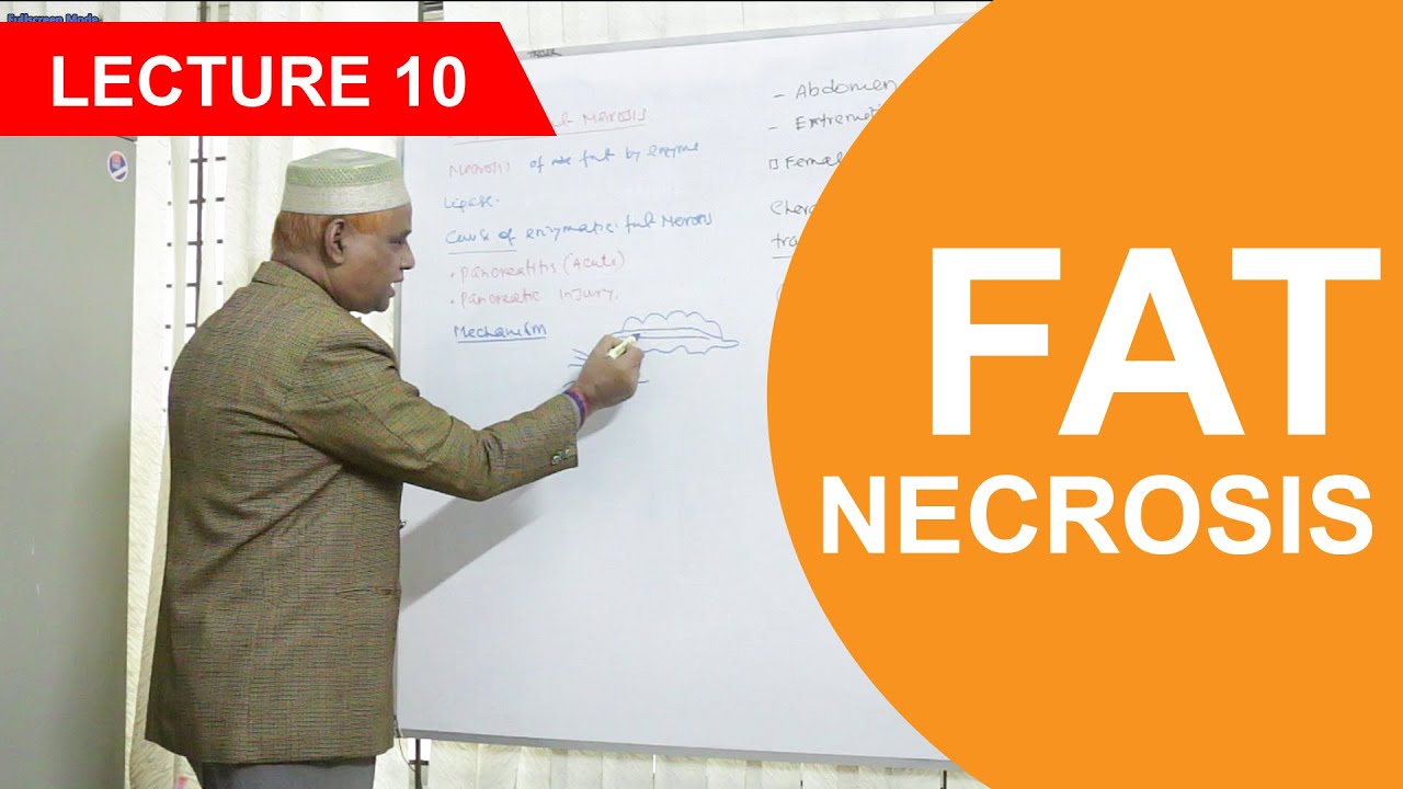 General Pathology: Lecture 10 | Fat Necrosis & Caseous Necrosis - YouTube