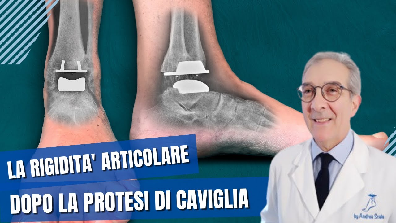 Perchè muovere subito la caviglia, dopo l'intervento di protesi di ...