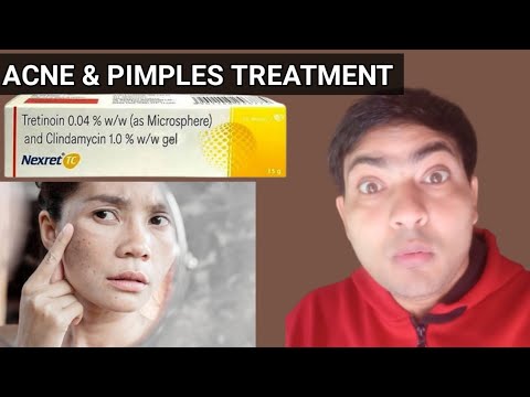 nexret tc gel use in hindi, nexret tc gel use - YouTube