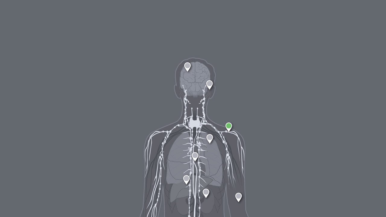 How can TCE exposure affect adults and children? - Immune System - YouTube