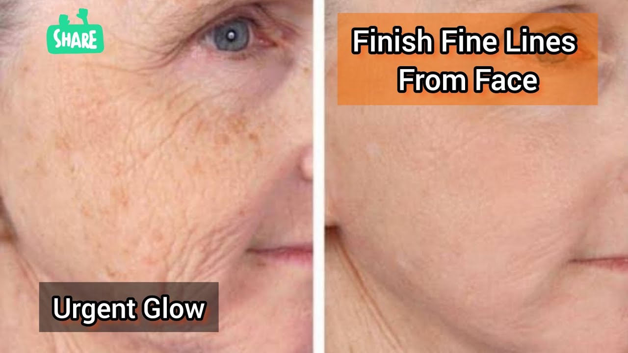 How To Get Rid Of Fine Lines Urgently At Home With Rice Flour- Gives ...