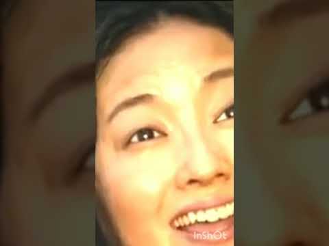 Woman's Plastic Surgery Fails And Her Head Turns Into A 2,000-Watt ...