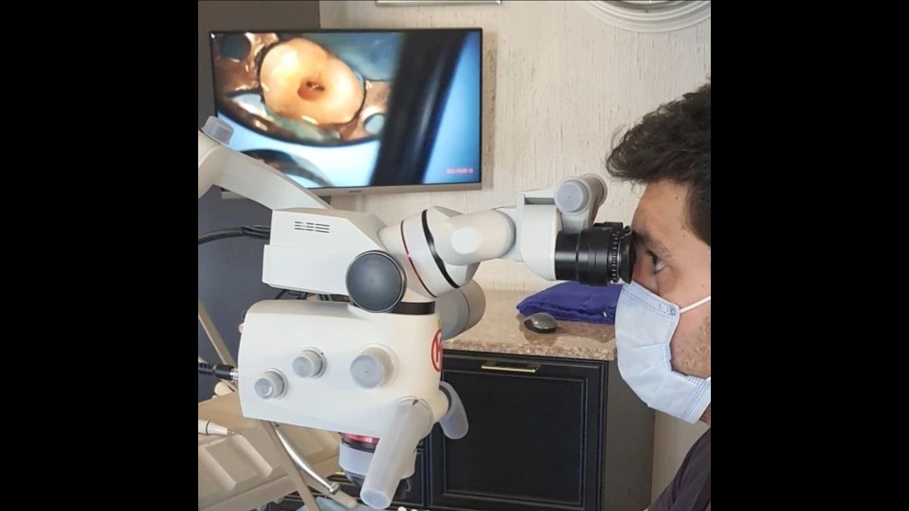 The Removal of Amalgam Fillings (Smart Protocol) - Amalgam Dolgu Sökümü - YouTube