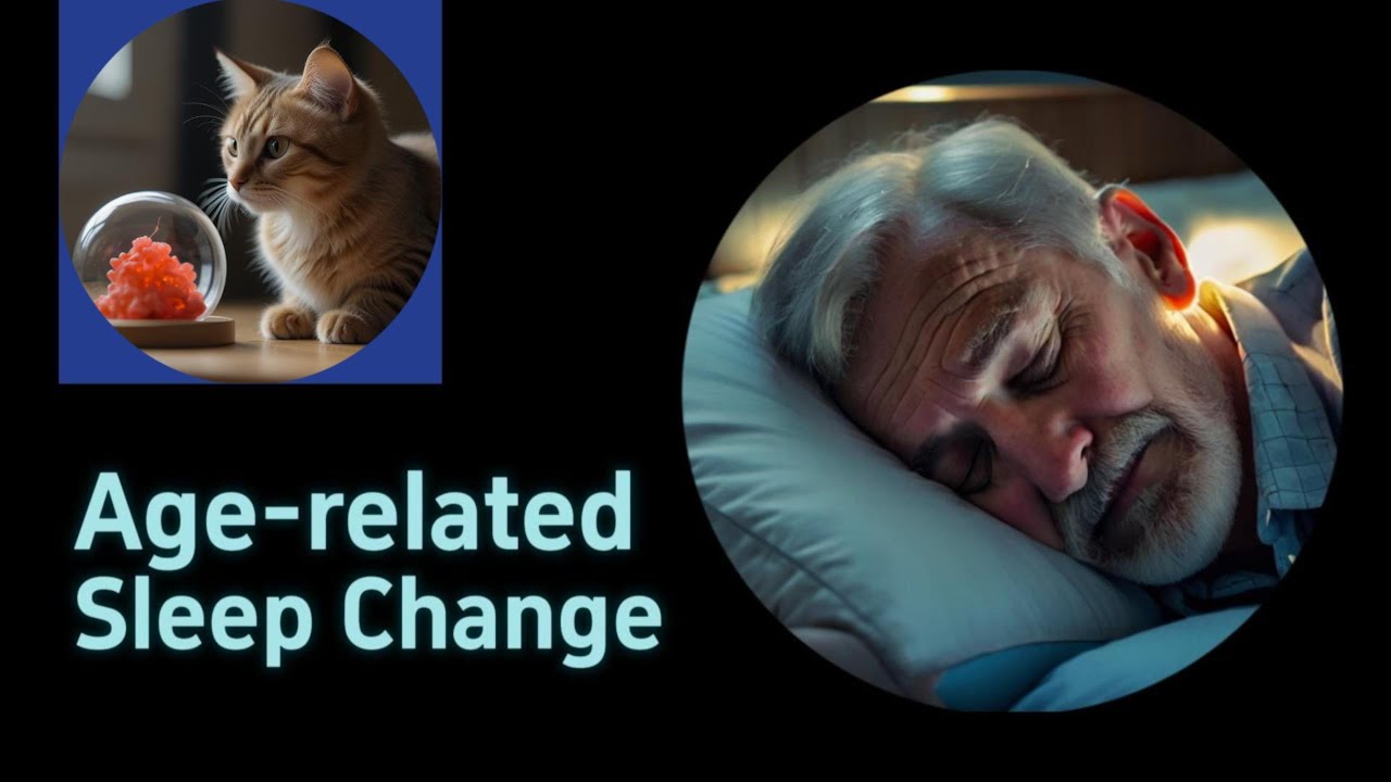 Age-related Sleep Change - Insomnia | USMLE UWorld Question, USMLE Step 1, Nervous System - YouTube
