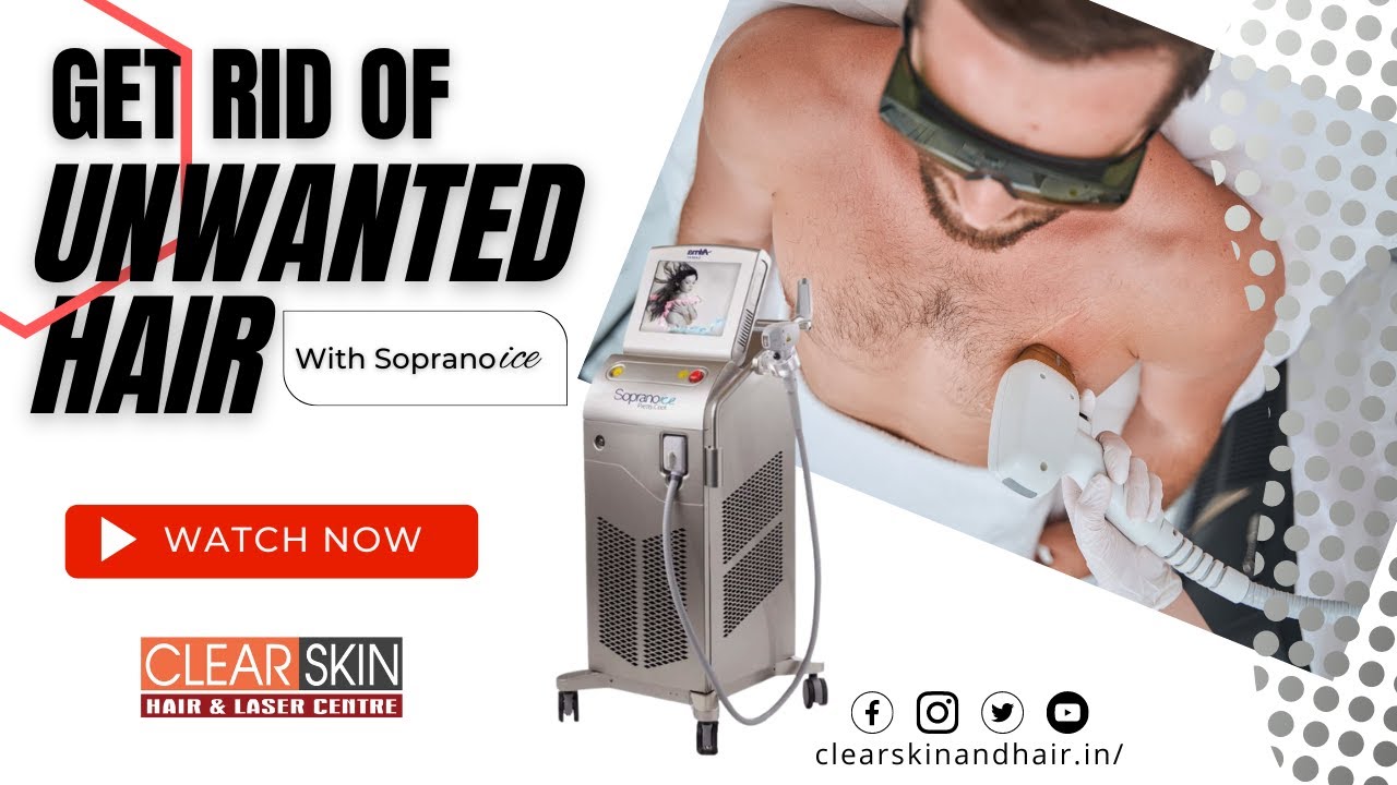 Super Laser Hair Removal Of The Chest || Men's Chest Laser Hair Removal ...