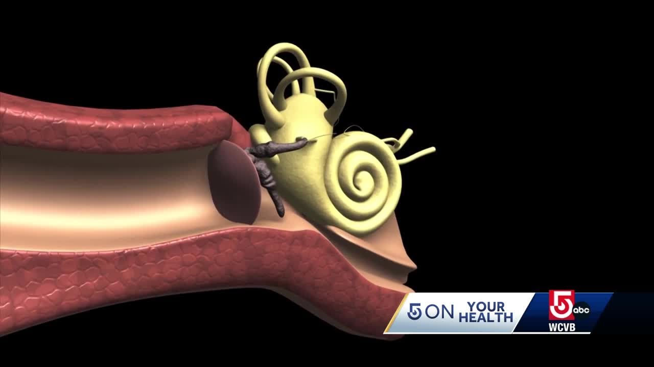 First of kind gene therapy restoring hearing, sight - YouTube