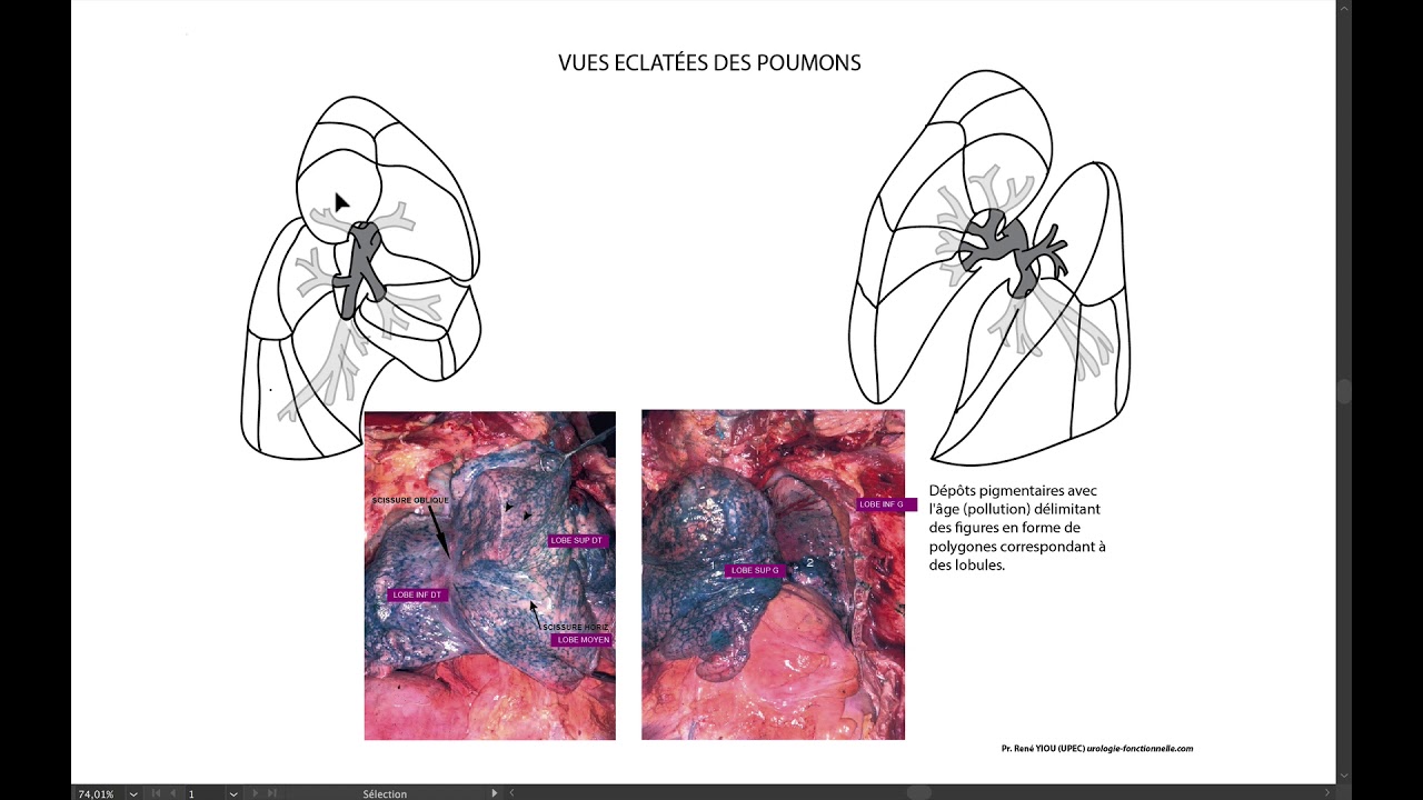 10b Segmentation pulmonaire vue éclatée - YouTube