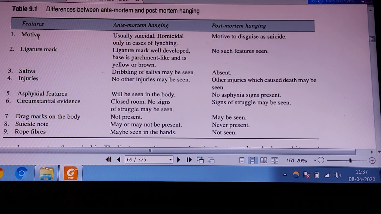 Differentiation between ante mortem hanging and post mortem suspension ...
