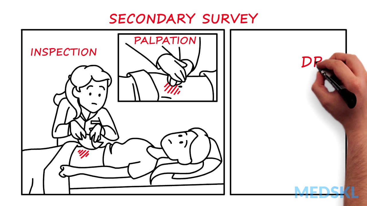 Abdominal Trauma Cartoons
