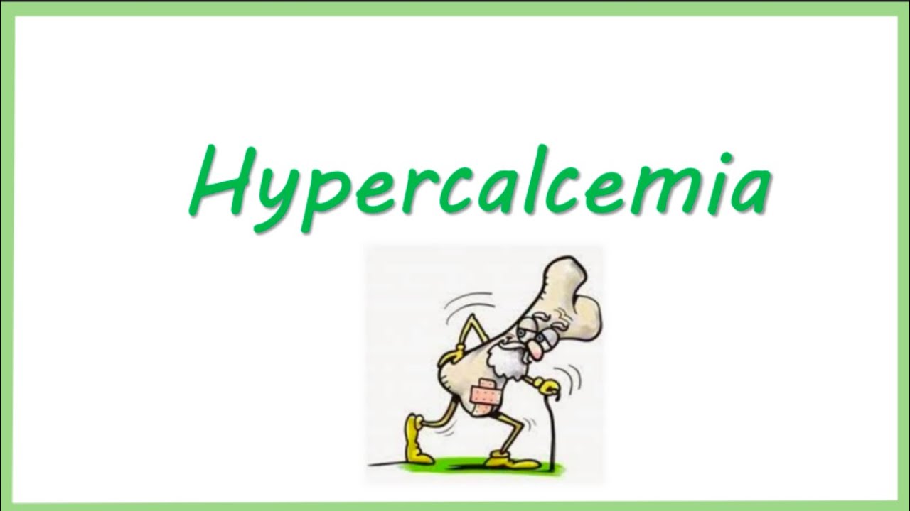Endocrine emergency 4⃣ Hypercalcemia by ASM Minds Team - YouTube