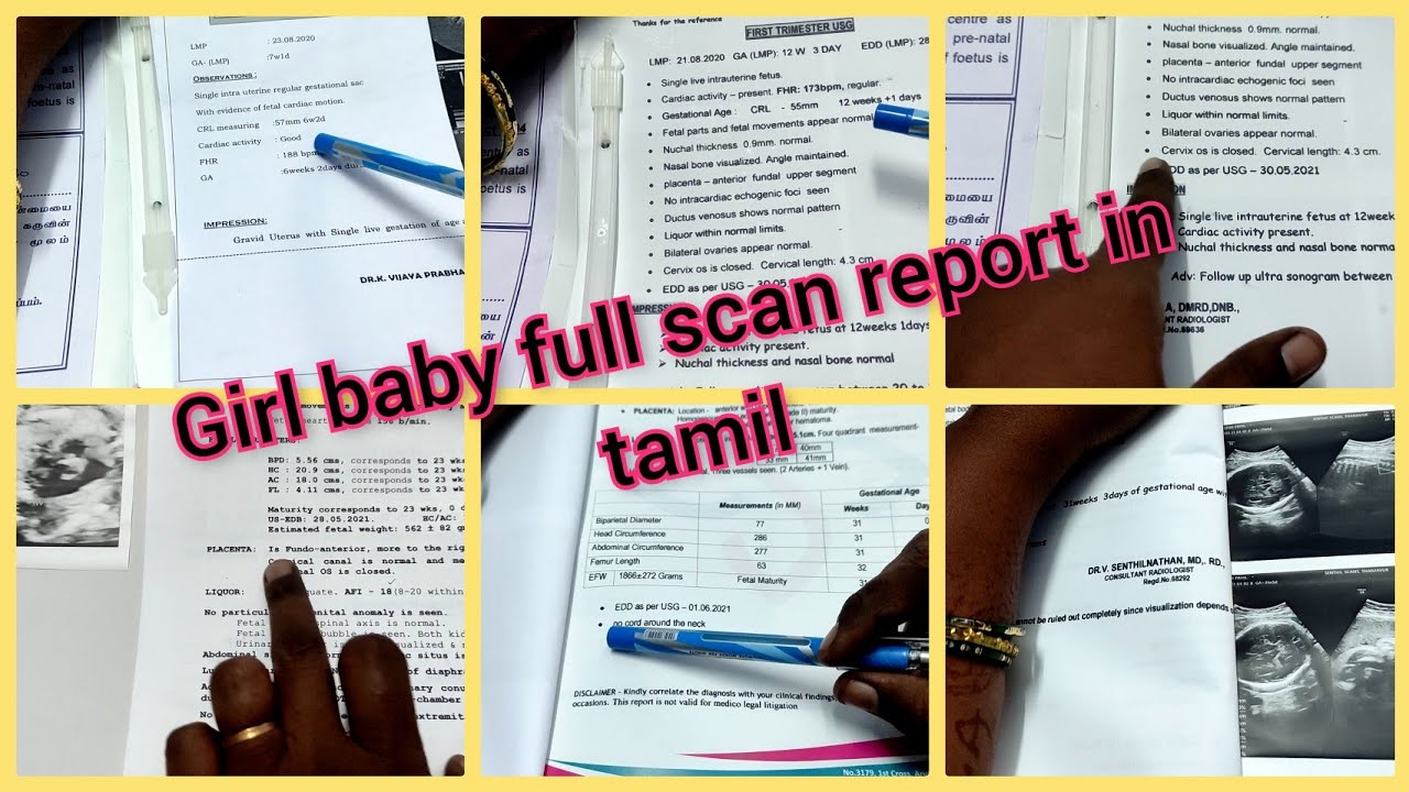 complete girl baby scan report clear explanation details in tamil/Girl ...