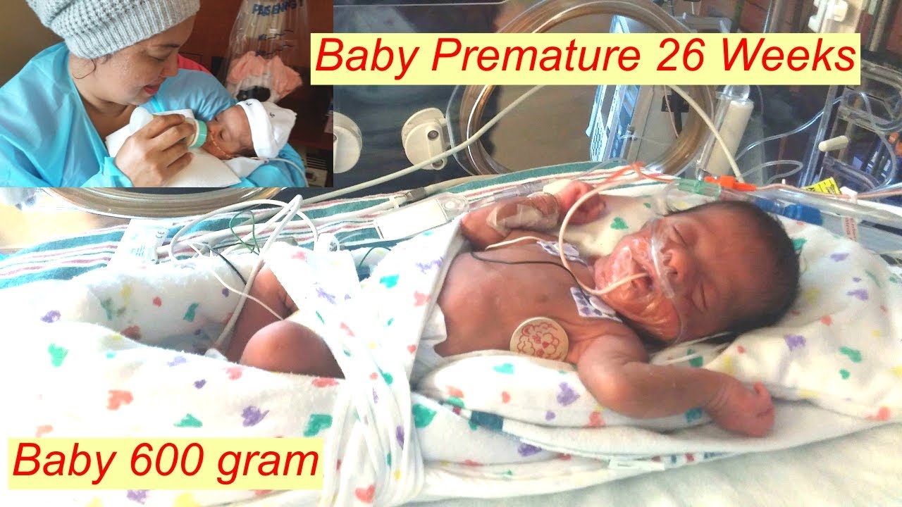 Baby Premature 26 Weeks // Baby 600 gram - YouTube