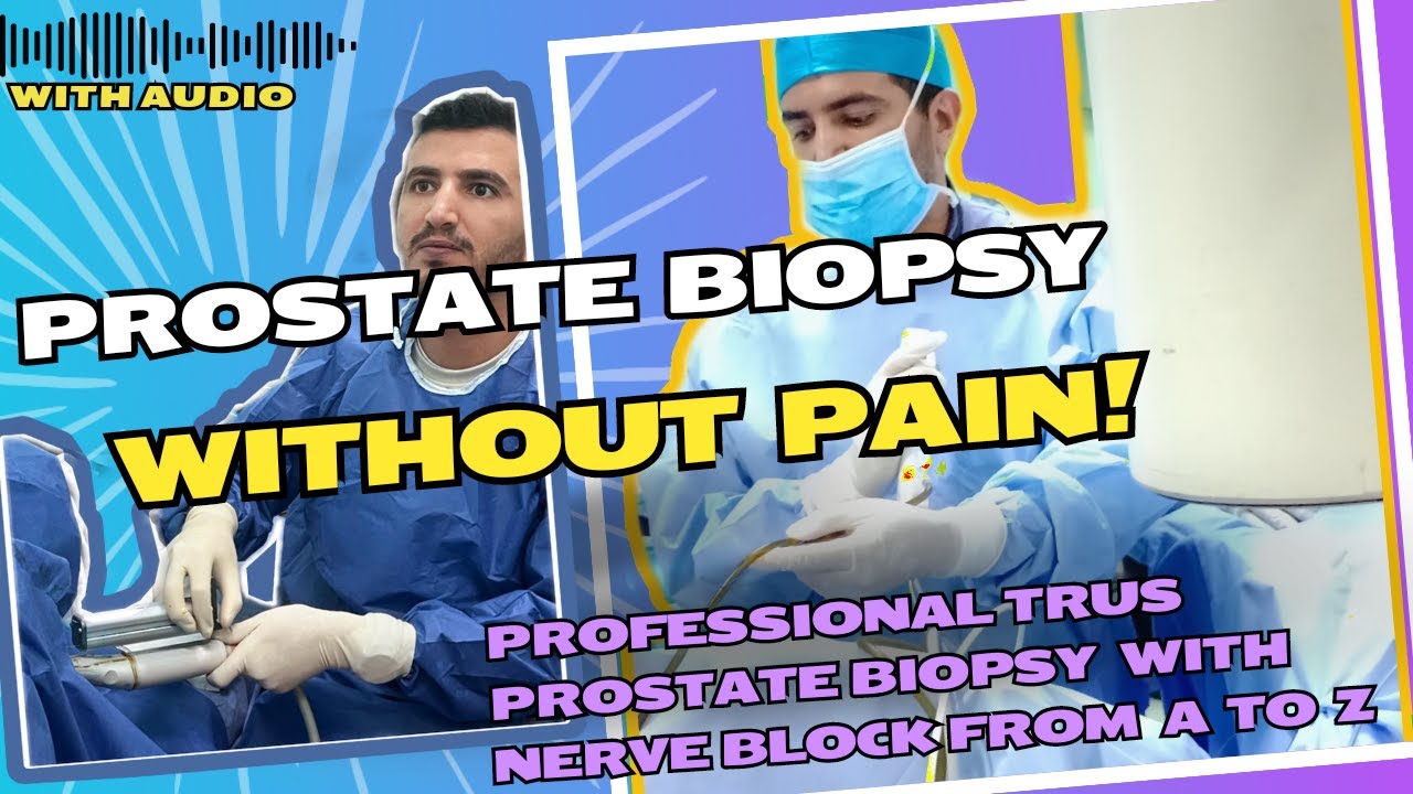TransRectal Ultrasound Guided Prostate Biopsy with PeriProstatic nerve ...