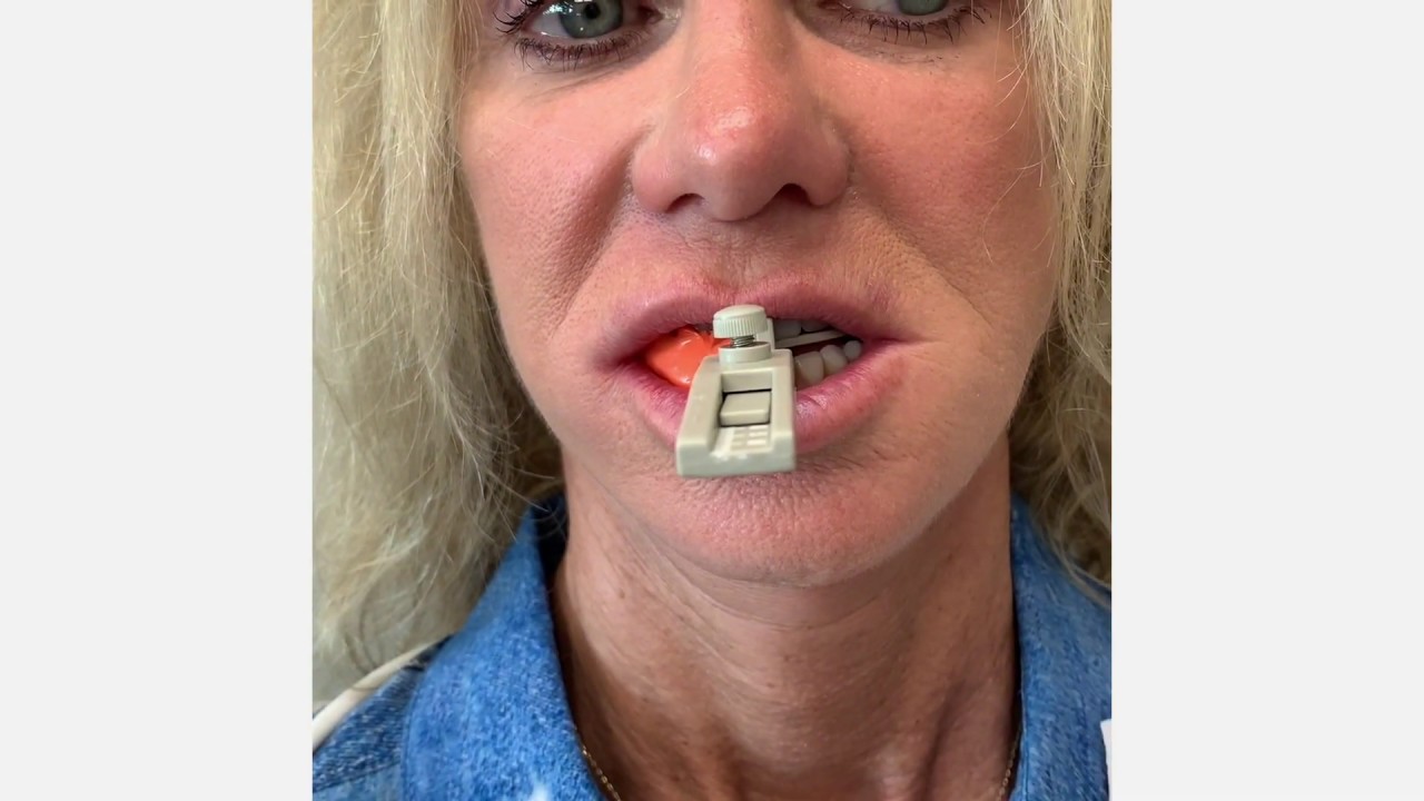 Taking a George Gauge Bite for Patients with Sleep Apnea, by Dr. Mitch ...