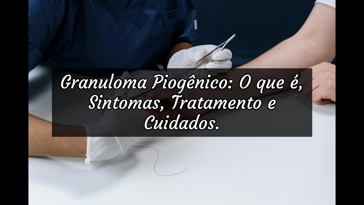 Granuloma Piogênico: O que é, Sintomas, Tratamento e Cuidados. - YouTube