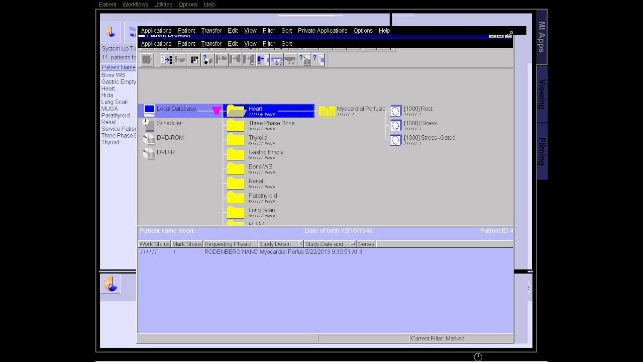 MI Apps Siemens Syngo - YouTube