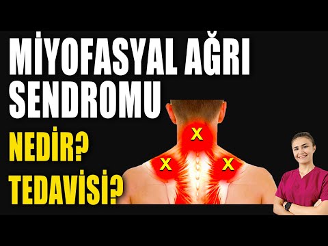 MİYOFASYAL AĞRI SENDROMU #aktifizyo #kulunçağrısı #boyunağrısı #fiziktedavi