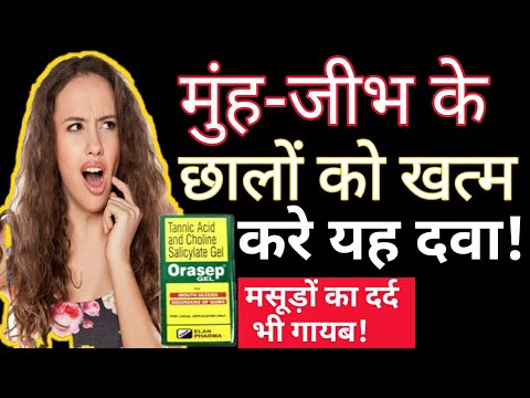 orasep gel || मुंह और जीभ के छालों को करे जड़ से खत्म || mouth ulcer ...