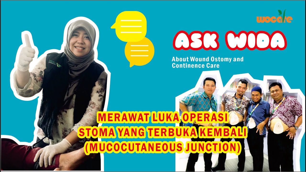 ASK WIDA #19 LUKA OPERASI STOMA TERBUKA KEMBALI (MUCOCUTANEOUS JUNCTION ...