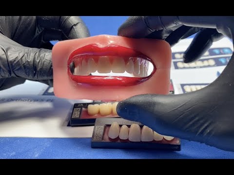 Dente de resina para prótese fixa e dentadura? O que eu preciso saber ...