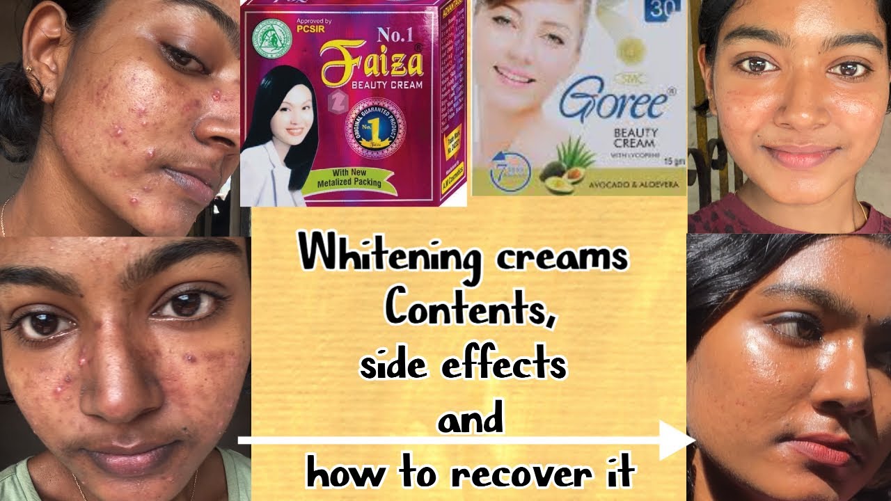 DAMAGE OF WHITENING CREAMS 🙆‍♀️🙇‍♀️|Contents , misuse and Side effects🥵 ...