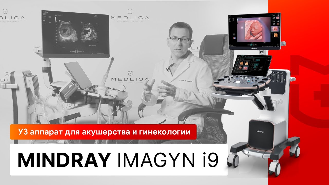 Обзор Mindray Imagyn i9. УЗИ аппарат для акушерства и гинекологии - YouTube