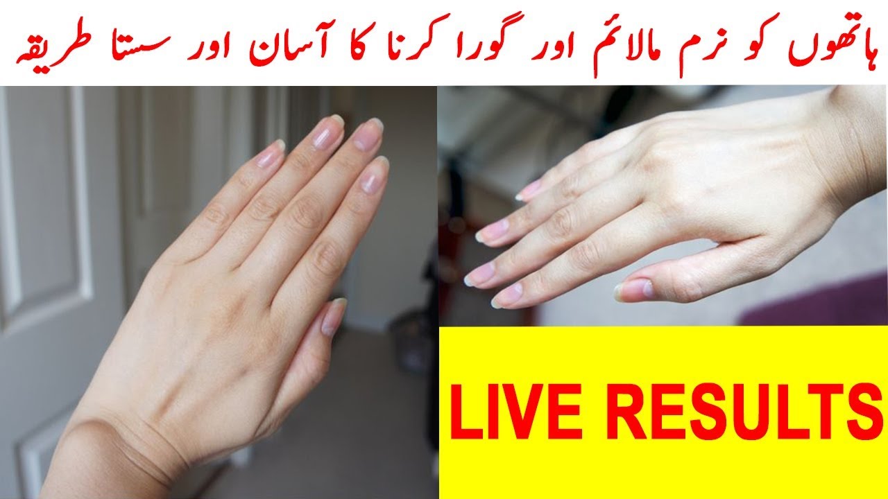 How to Get Baby Soft Smooth & Fairer Hands Naturally - Treat Dry and ...