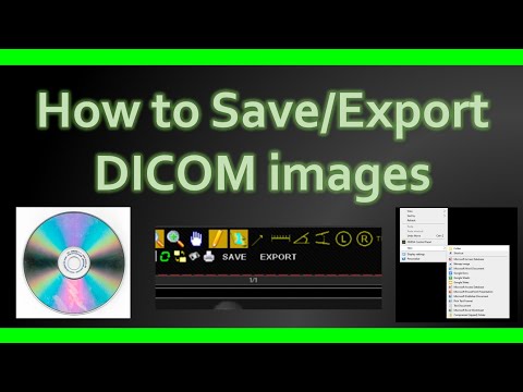 How to Save DICOM images 💿💽🖥️