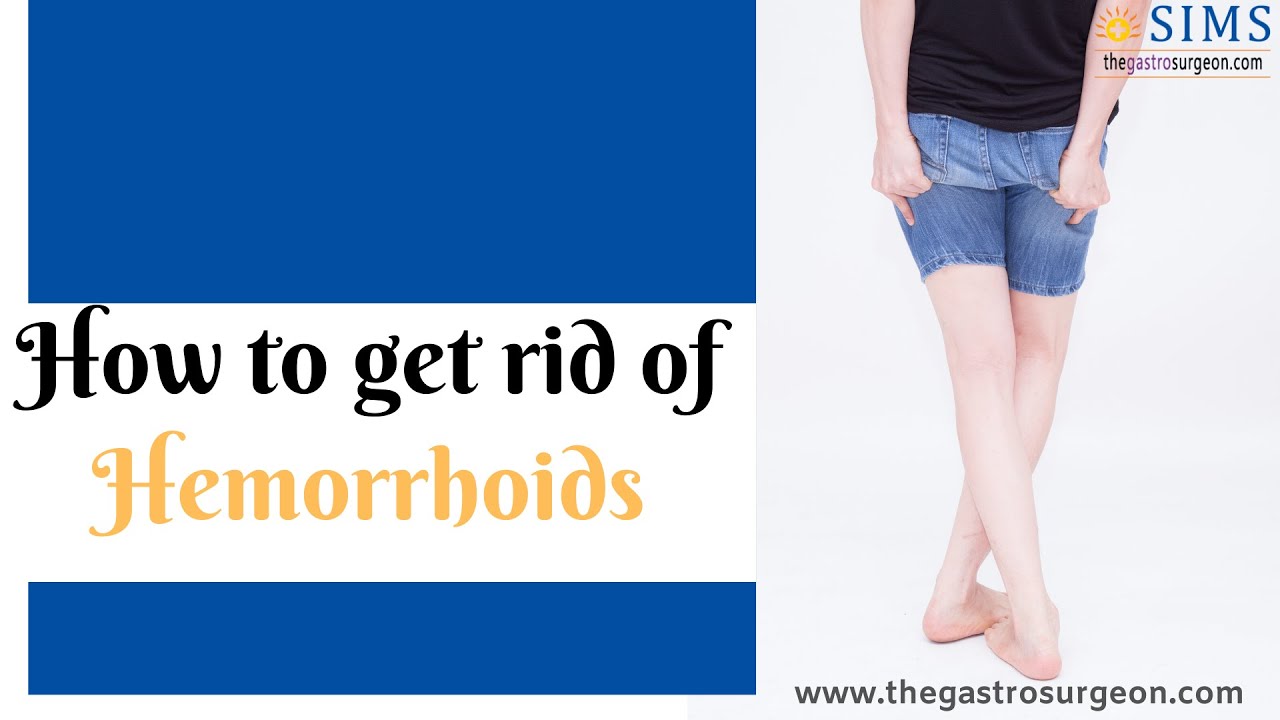 How to Get Rid of Hemorrhoids?| Hemorrhoid Treatment in Chennai| Best ...