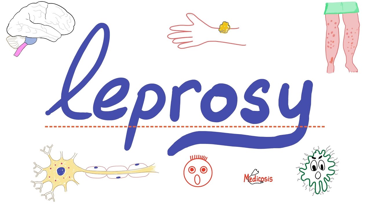 Leprosy (Hansen Disease) - Mycobacterium leprae - Microbiology 🧫 ...