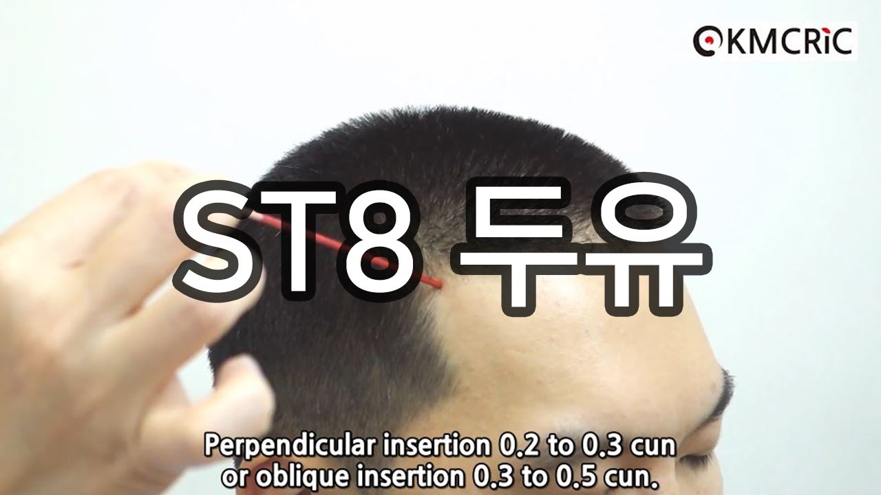 ST8 두유 頭維 Touwei (Eng sub) - KMCRIC WHO Standard acupoint DB - YouTube