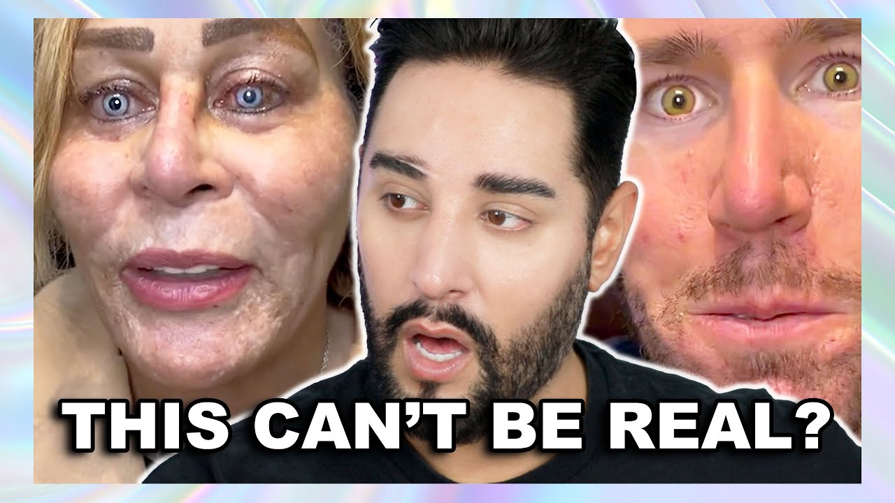 Permanent Eye Color Surgery Gone Very Wrong - YouTube