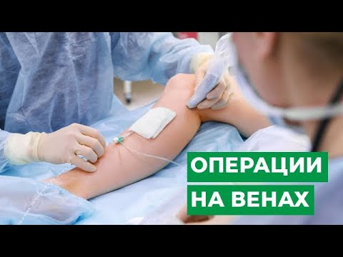 Операции на венах. Варикозное расширение вен нижних конечностей. - YouTube