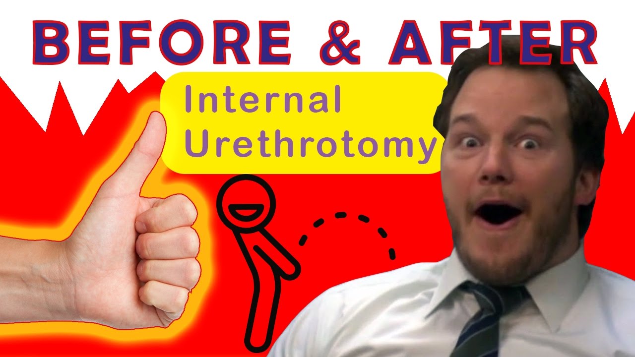 Internal Urethrotomy / Before & After - Üretra Darlığı / Öncesi ve ...