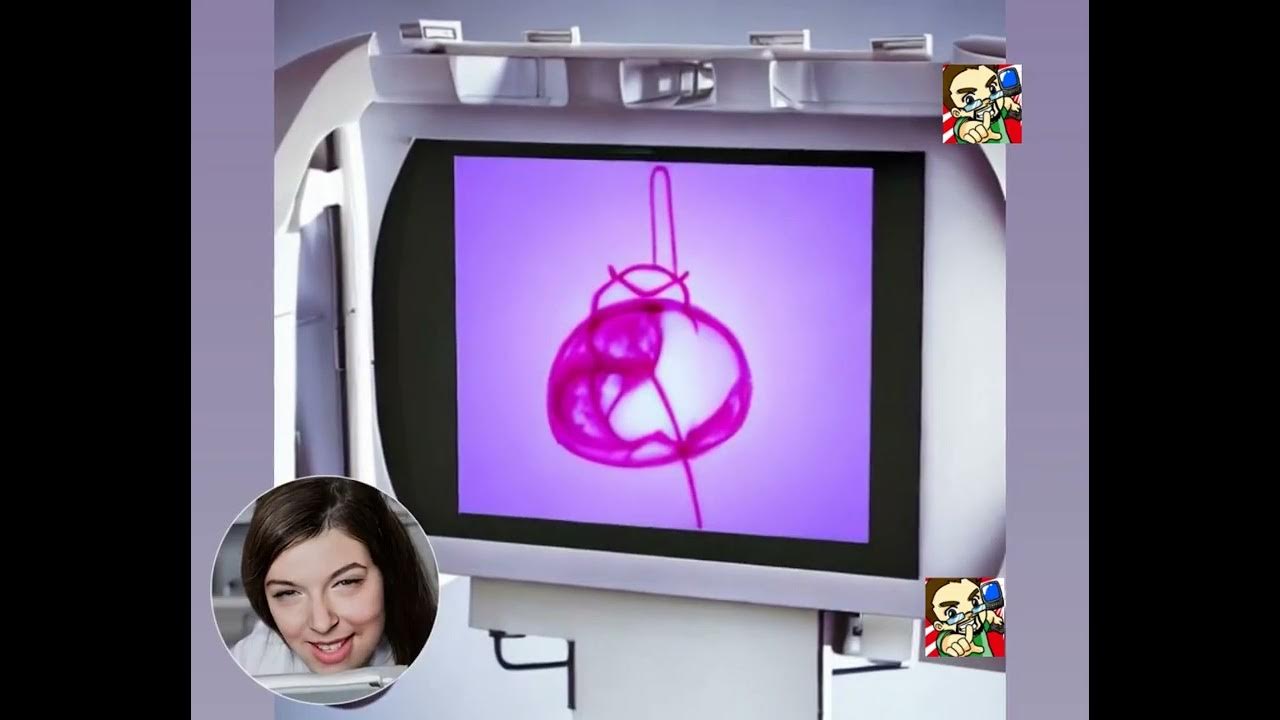 A Yolo Based Model for Breast Cancer Detection in Mammograms - YouTube