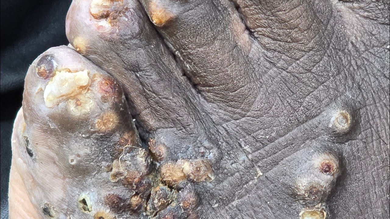 Solomon Andanje's #2 very first jigger digging - see long videos ...
