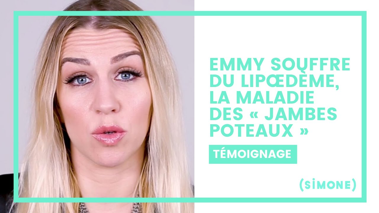 EMMY SOUFFRE DU LIPŒDÈME, LA MALADIE DES « JAMBES POTEAUX » - YouTube